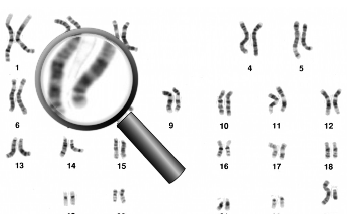 Finding Copy Number Variants